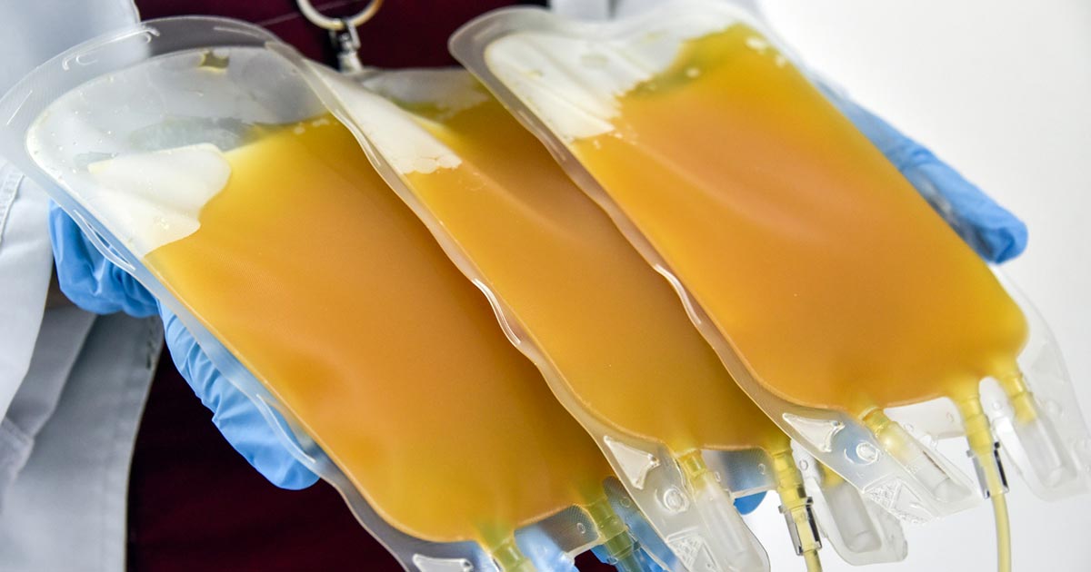 Des scientifiques tchèques travaillent sur un substitut au plasma ...